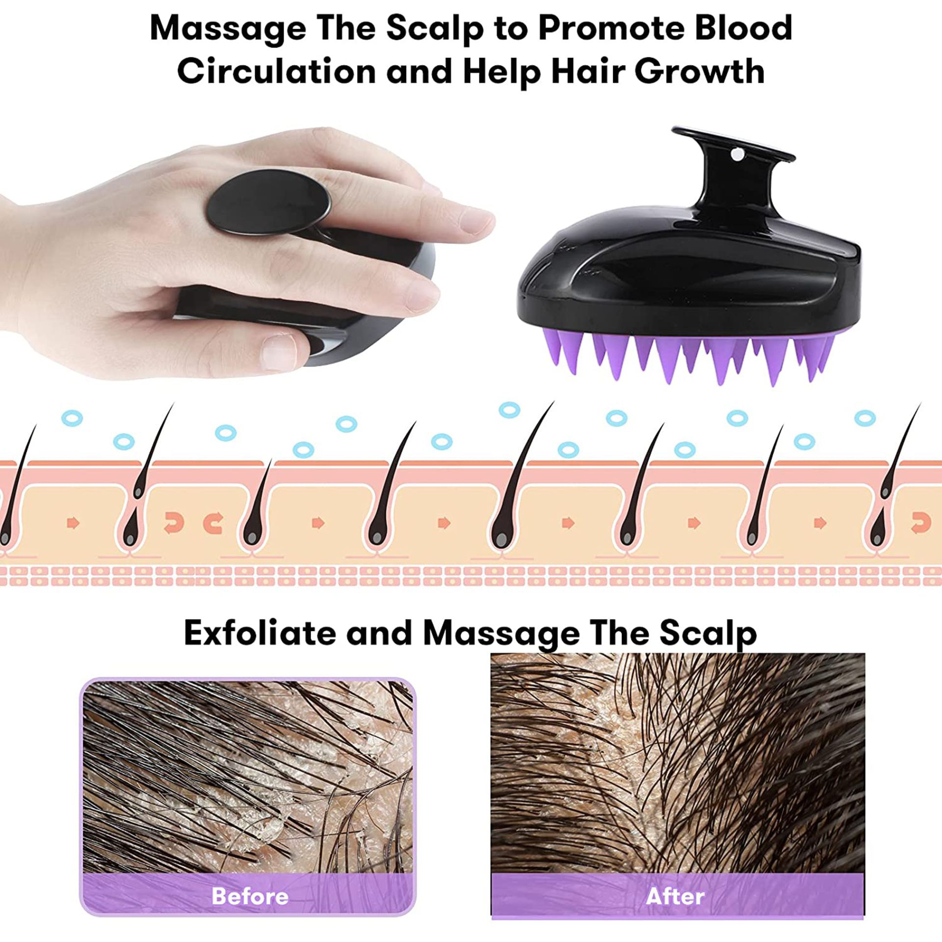 Title: Scalpel Brush, Shampoo, Massage (Pack of 4)Description: Made of ...